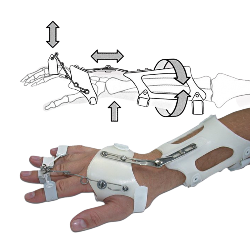What Is A Dynamic Wrist Splint at Betty Crosby blog What Is A Dynamic Wrist Splint at Betty Crosby blog